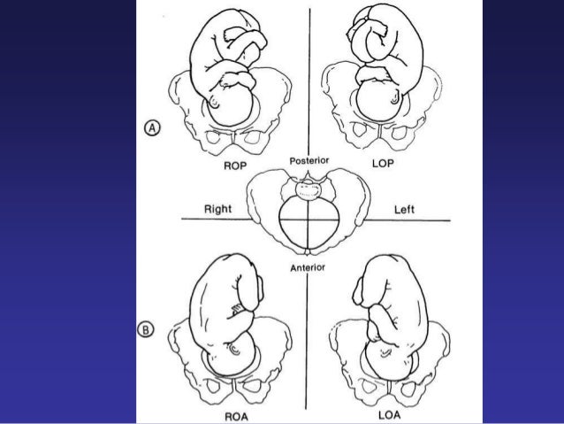 Fetal head, maternal pelvis & pelvimetry