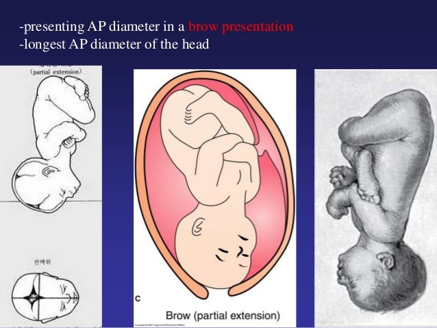 Fetal head, maternal pelvis & pelvimetry