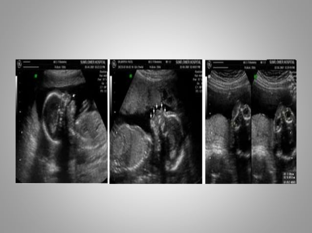 Fetal head & neck usg | PPTX | Pregnancy | Reproductive Health