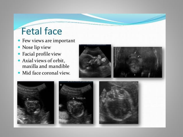Fetal head & neck usg | PPTX | Pregnancy | Reproductive Health