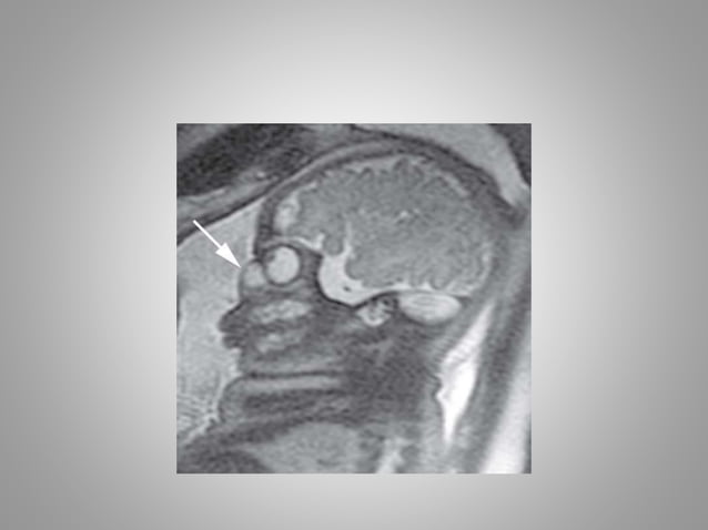 Fetal head & neck usg | PPTX | Pregnancy | Reproductive Health