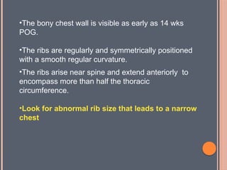 Congenital anomalies mixed appearance of fetal heart and chest.pptx