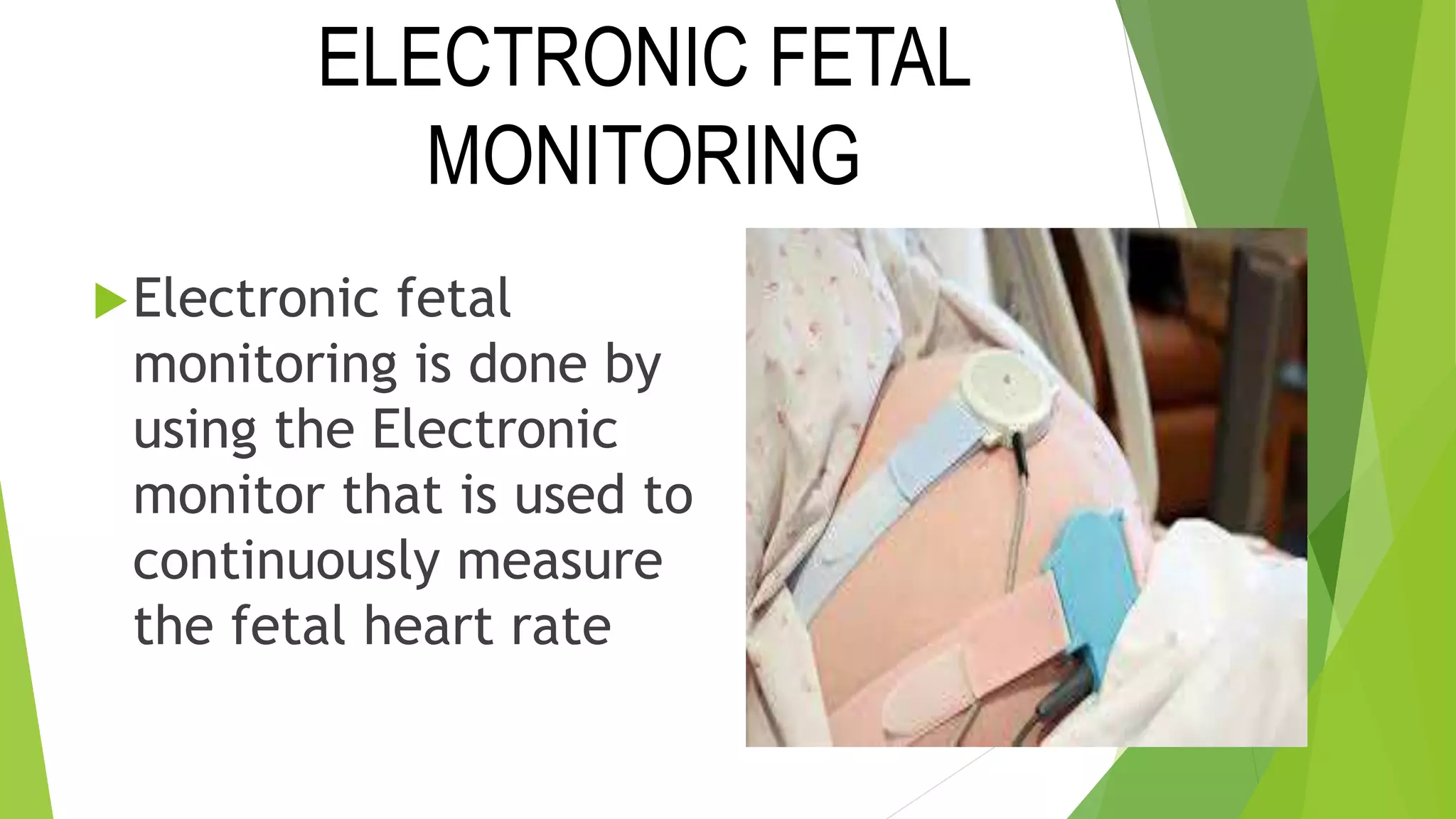 Fetal heart rate monitoring | PPTX