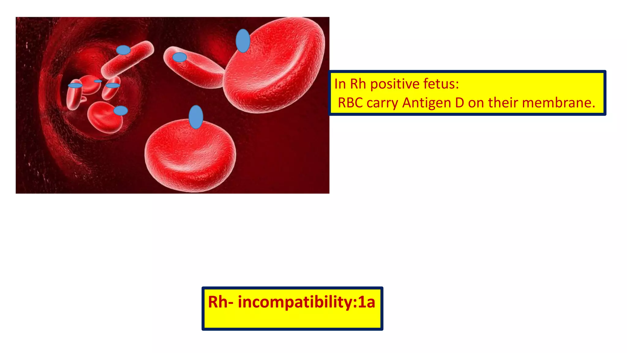 Fetal hemoglobin and rh incompatibility | PDF