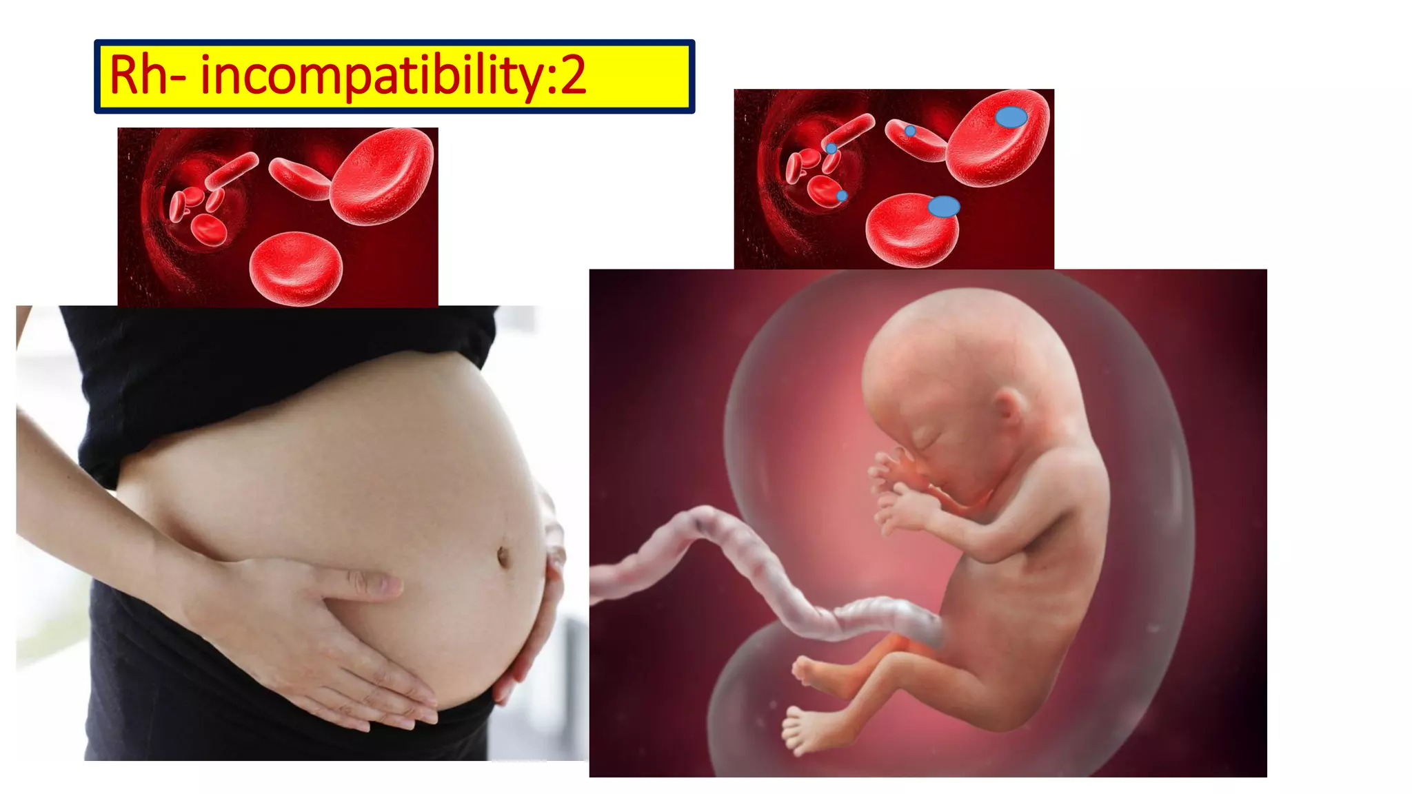 Fetal hemoglobin and rh incompatibility | PDF