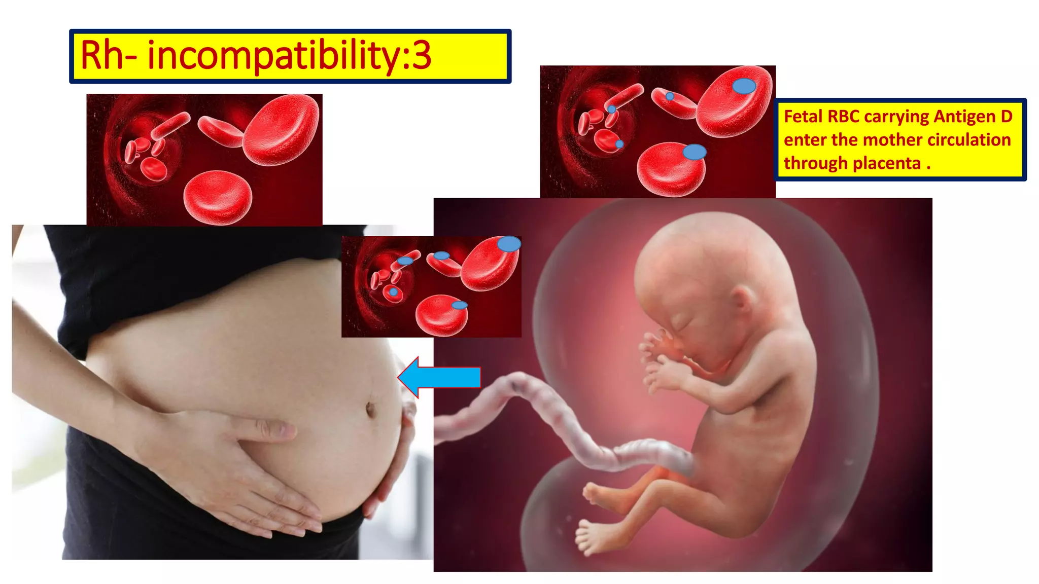 Fetal hemoglobin and rh incompatibility | PDF