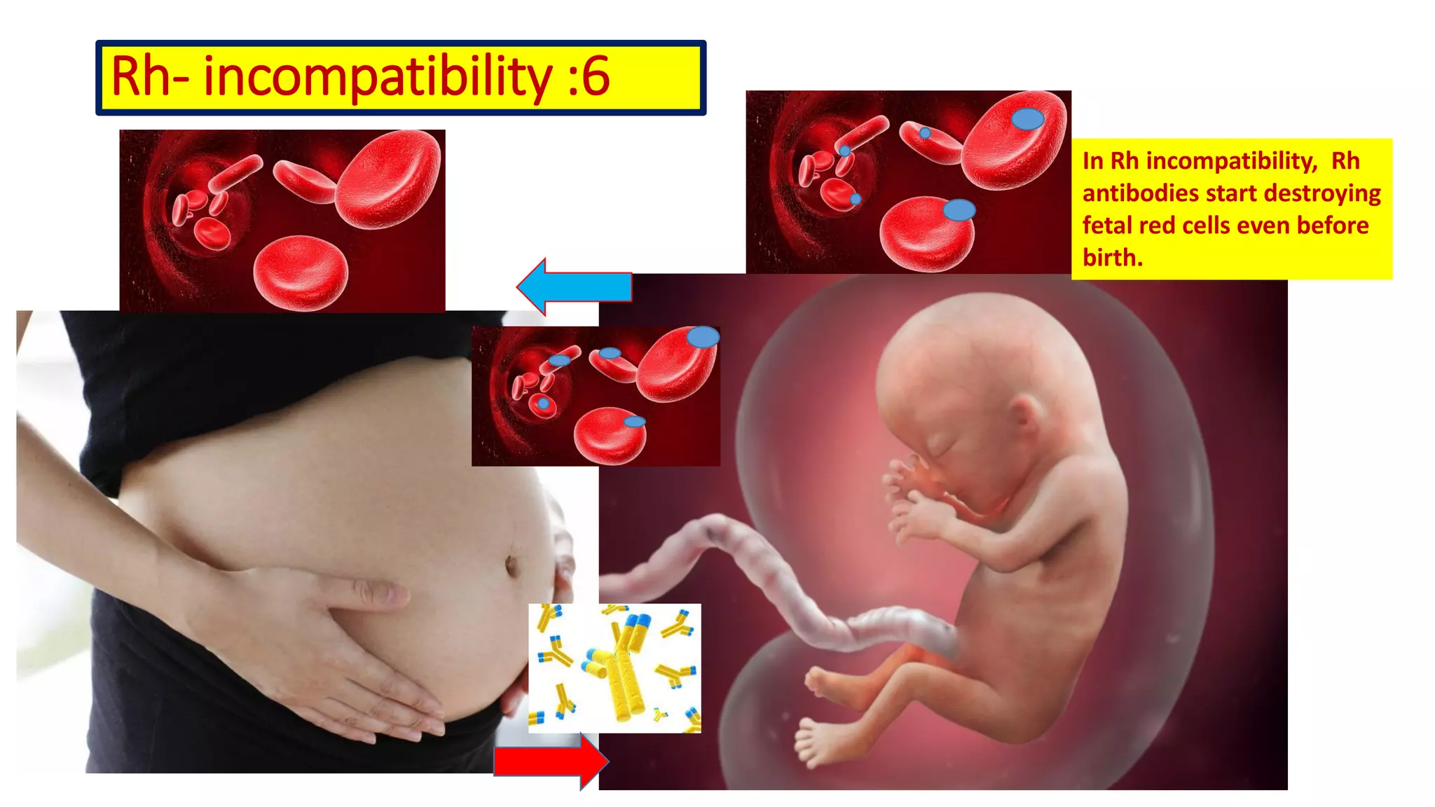 Fetal hemoglobin and rh incompatibility | PDF