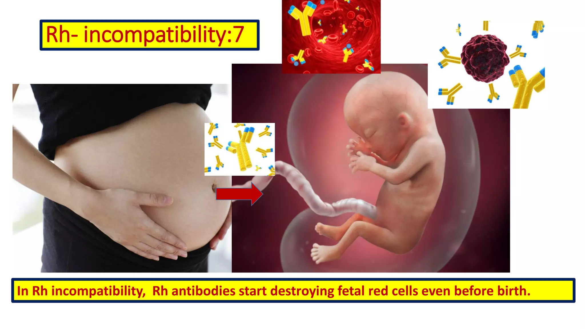 Fetal hemoglobin and rh incompatibility | PDF