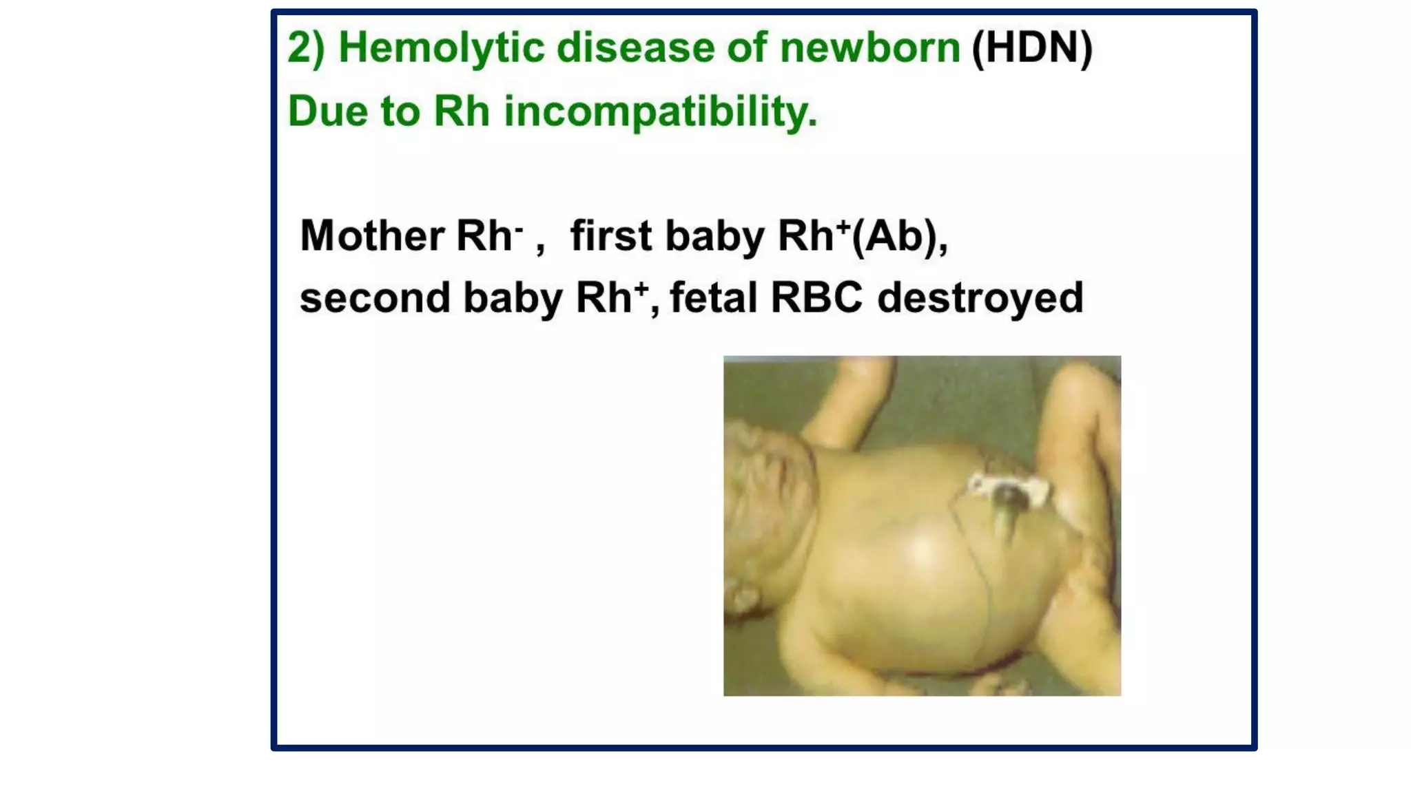 Fetal hemoglobin and rh incompatibility | PDF