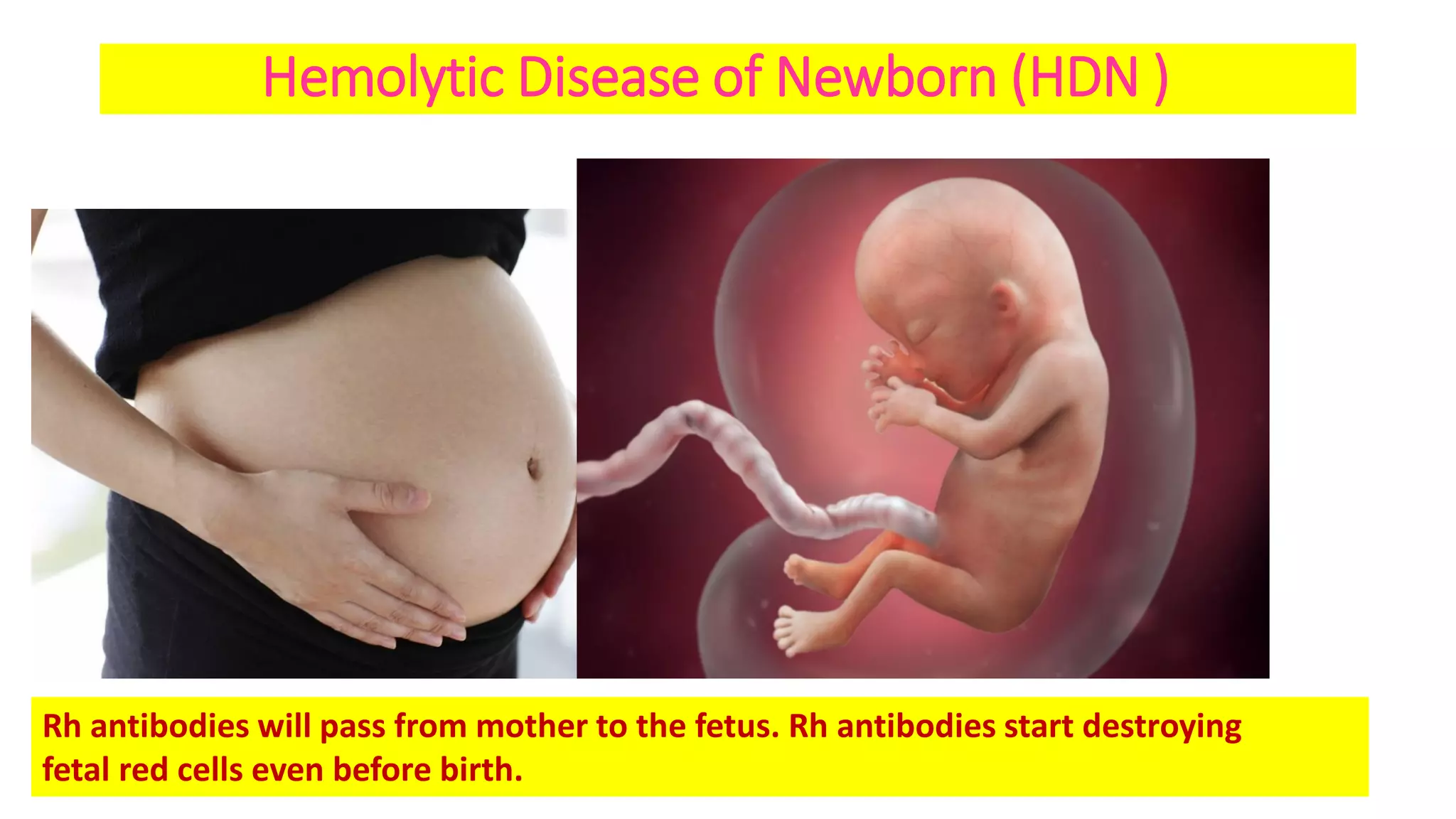 Fetal hemoglobin and rh incompatibility | PDF