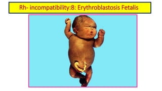 Fetal hemoglobin and rh incompatibility | PDF