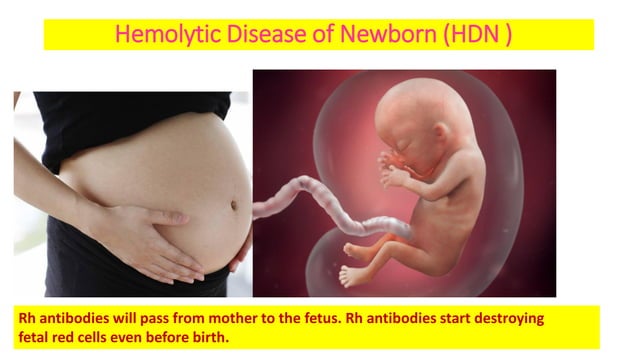 Fetal hemoglobin and rh incompatibility | PDF | Pregnancy ...