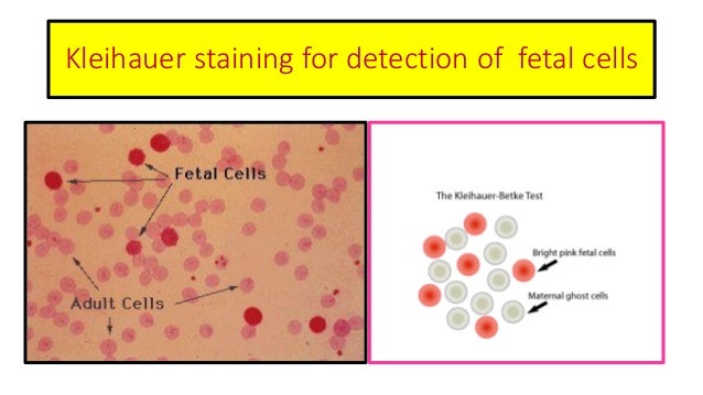 Fetal hemoglobin and rh incompatibility