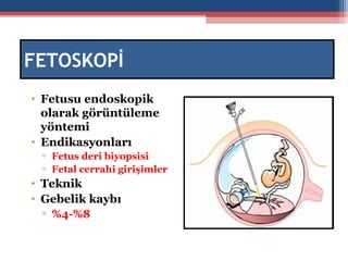 Fetal invaziv girişimler slideshare | PPT