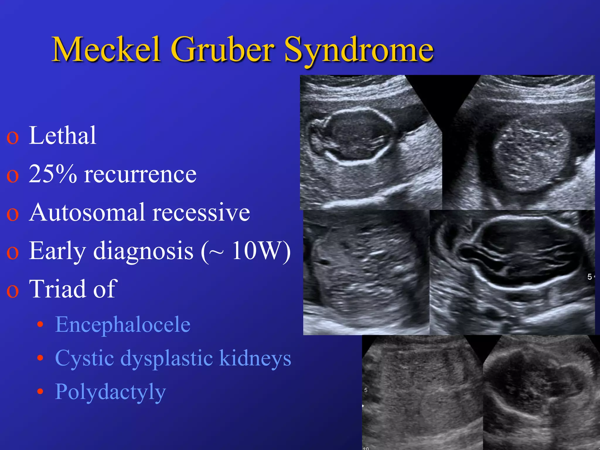 Antenatal diagnosis of Congenital Anomalies of Kidneys and Urinary ...