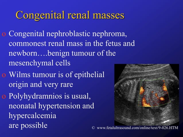 Antenatal diagnosis of Congenital Anomalies of Kidneys and Urinary ...
