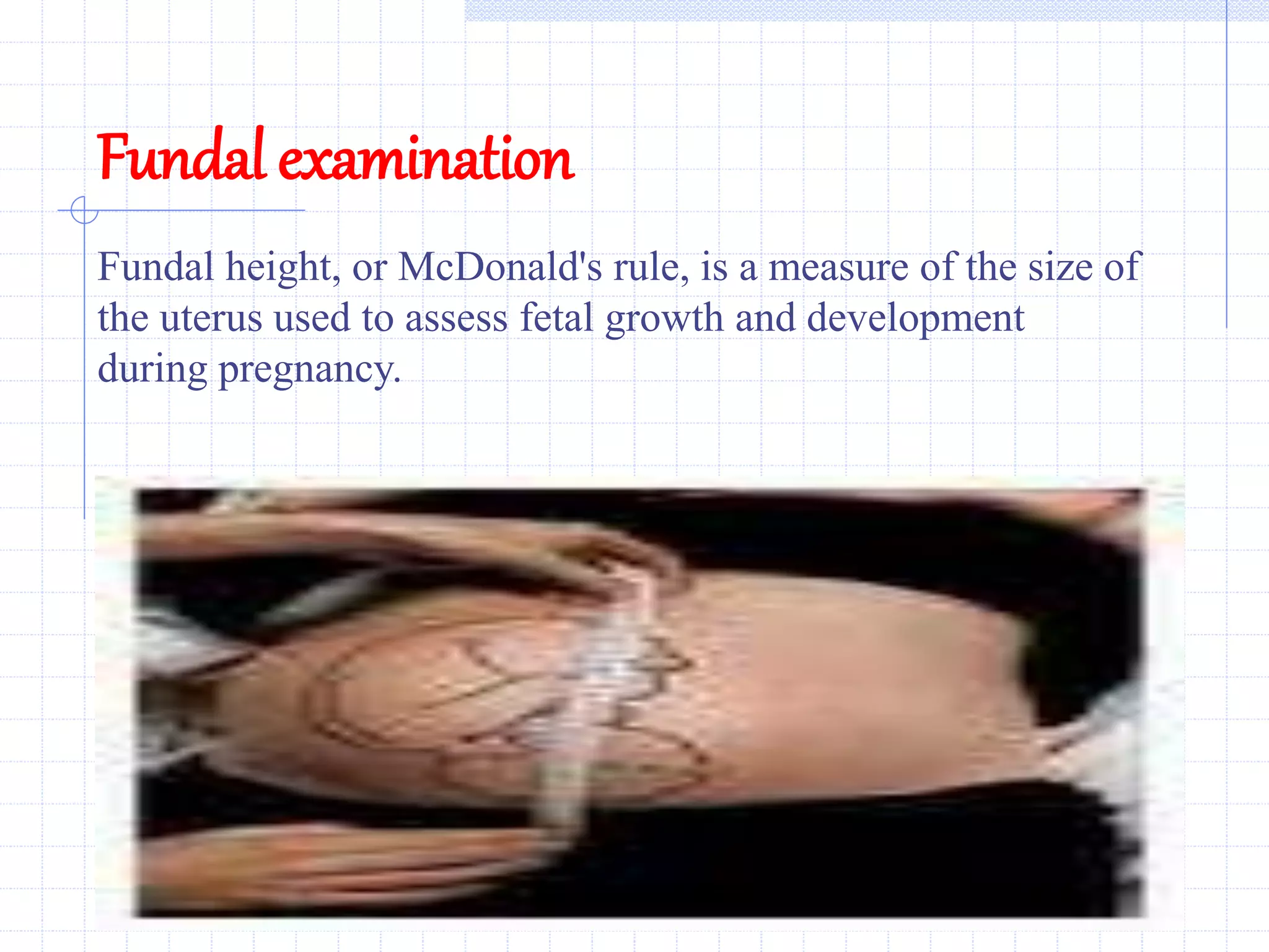 Fetal measures | PPTX