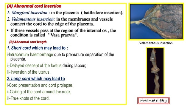 Fetal membranes , placenta and twins