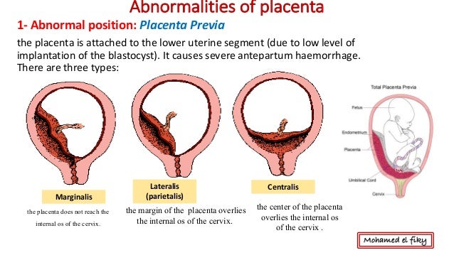 Fetal membranes , placenta and twins