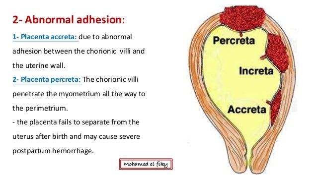Fetal membranes , placenta and twins