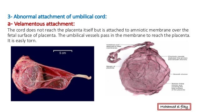 Fetal membranes , placenta and twins