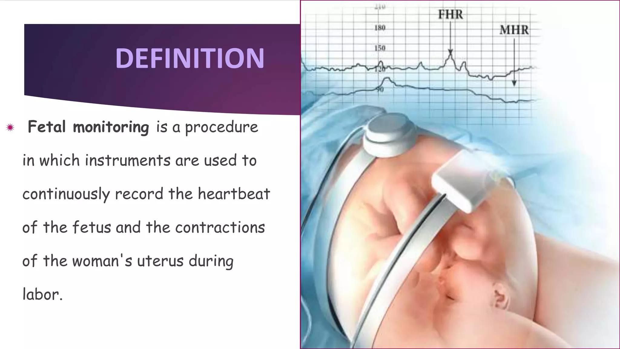 Types of Fetal monitoring | PPTX