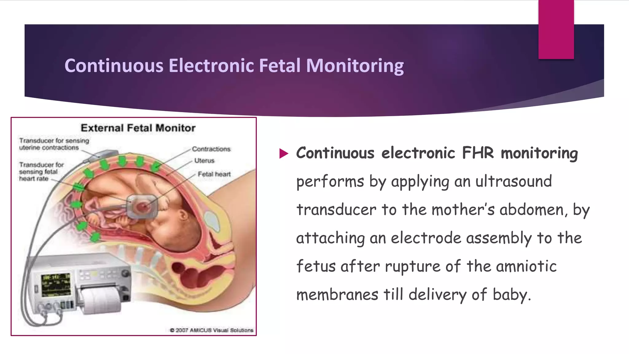 Types of Fetal monitoring | PPTX