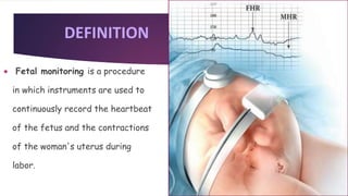 Types of Fetal monitoring | PPTX