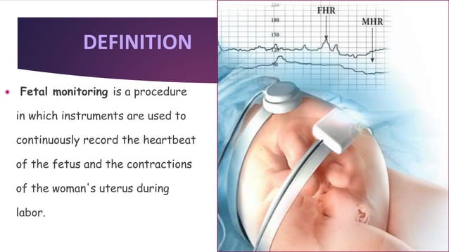 Types of Fetal monitoring | PPTX | Pregnancy | Reproductive Health