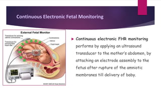 Types of Fetal monitoring | PPTX