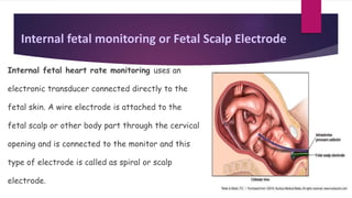 Types of Fetal monitoring | PPTX | Pregnancy | Reproductive Health