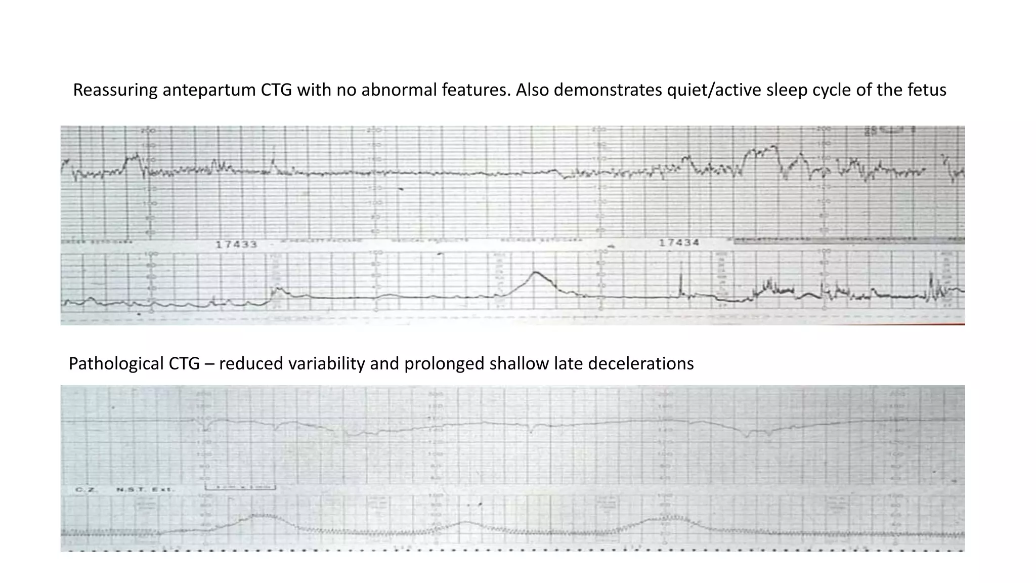 Fetal monitoring.pptx