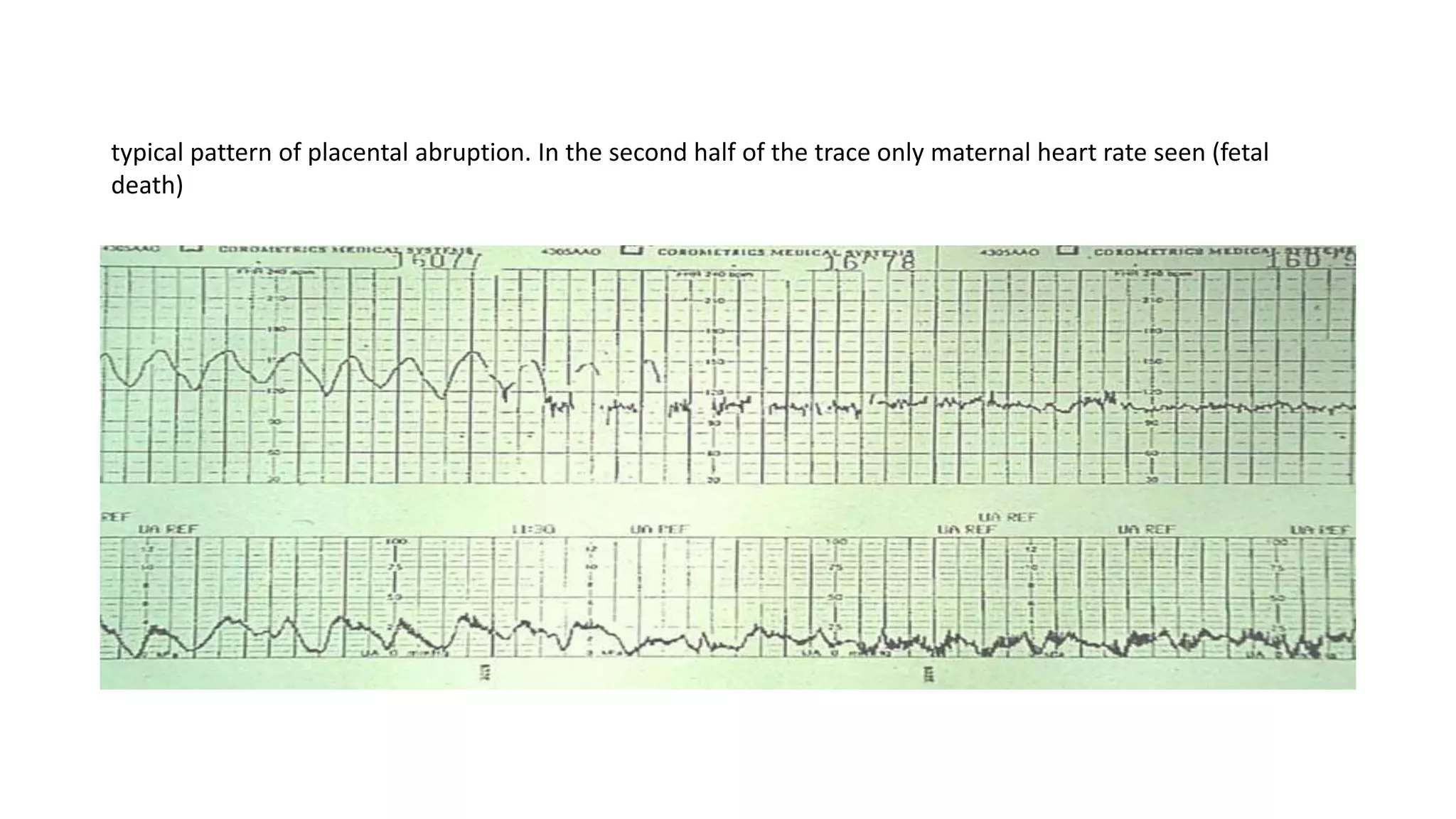 Fetal monitoring.pptx