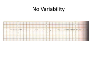 Fetal_Monitoring.pptx