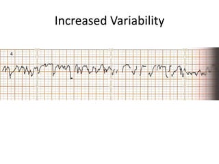 Fetal_Monitoring.pptx