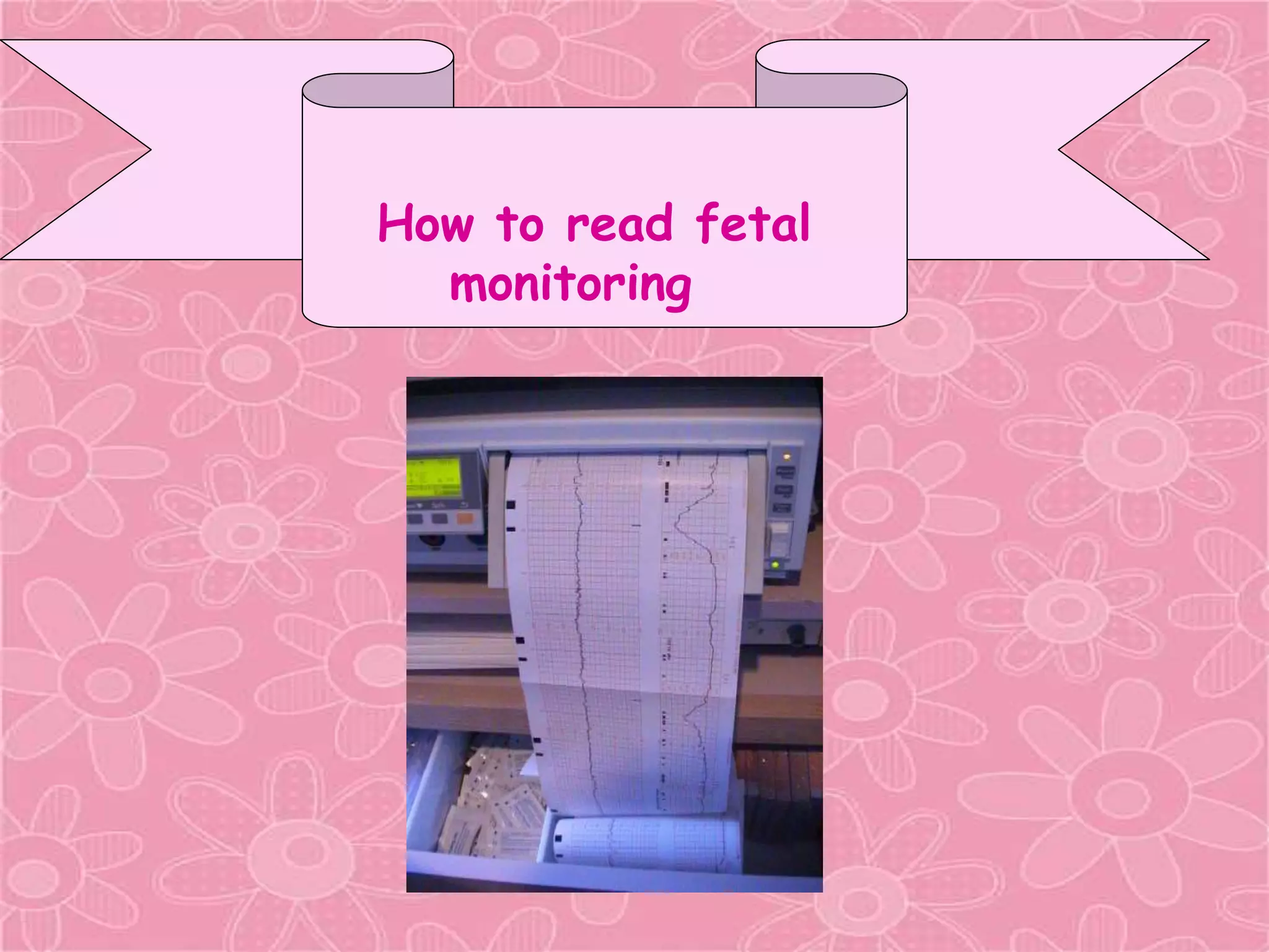 fetal monitoring (2).ppt