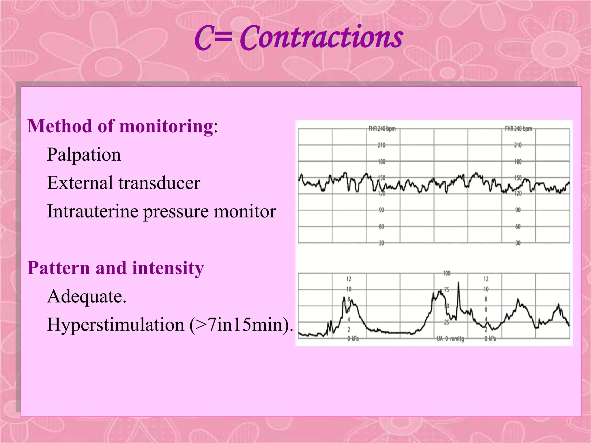 fetal monitoring (2).ppt