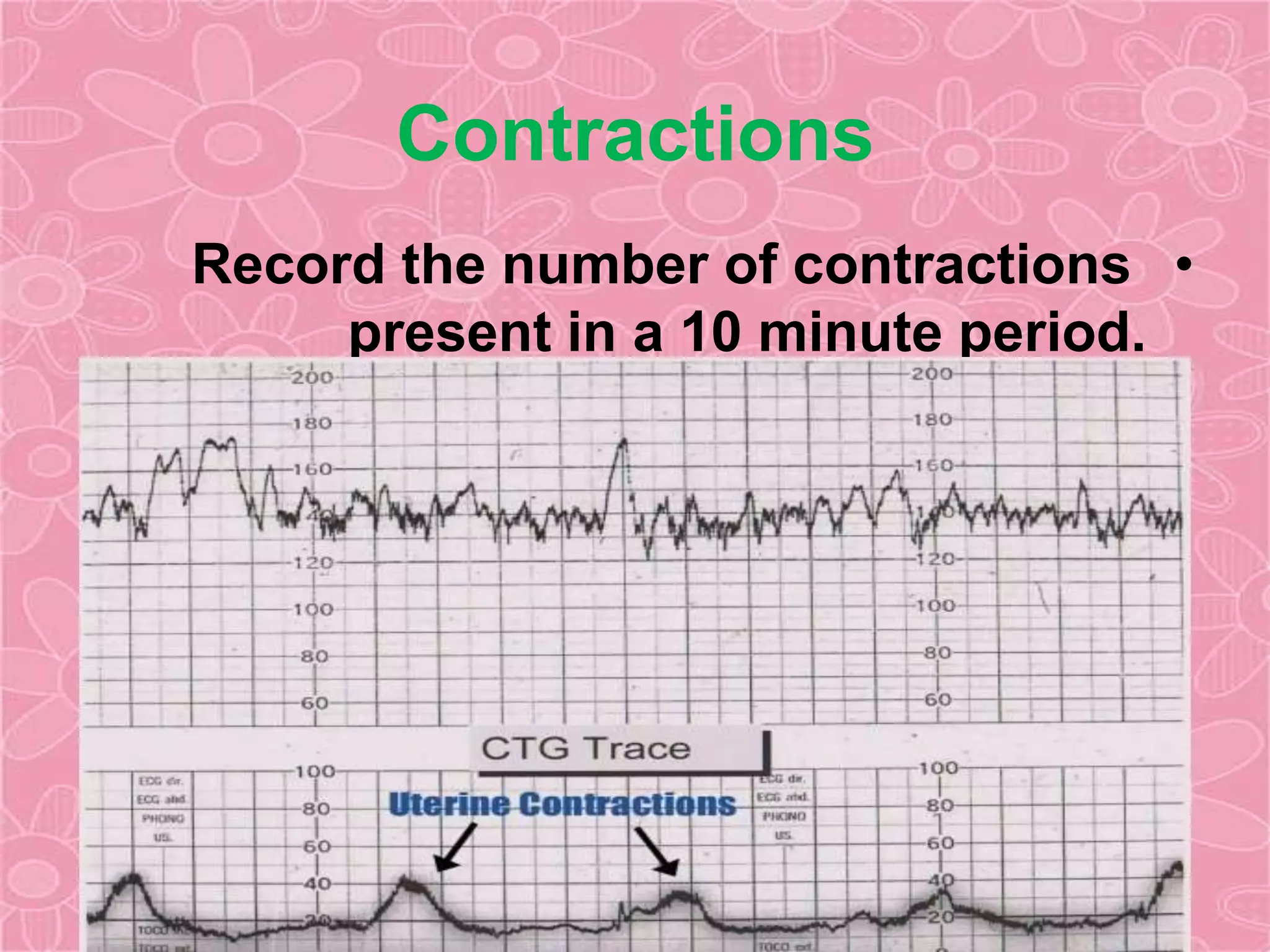 fetal monitoring (2).ppt