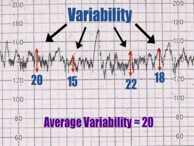 fetal monitoring (2).ppt | Pregnancy | Reproductive Health