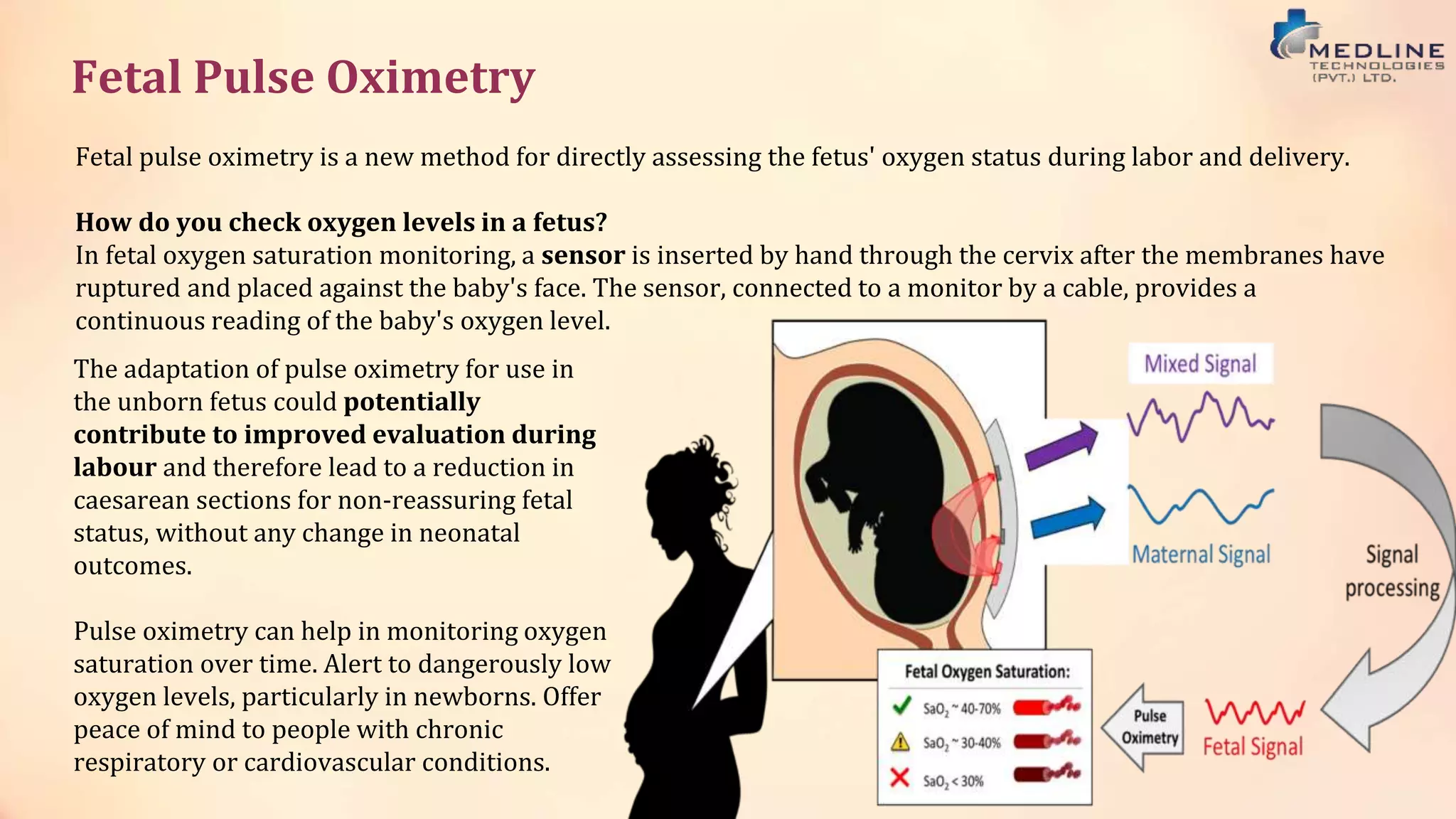 Fetal Monitoring Devices | PPTX