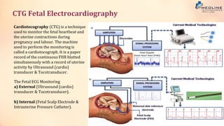 Fetal Monitoring Devices | PPTX