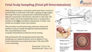 Fetal Monitoring Devices | PPTX