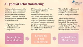 Fetal Monitoring Devices | PPTX