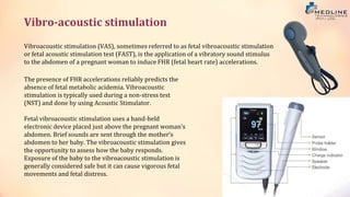 Fetal Monitoring Devices | PPTX