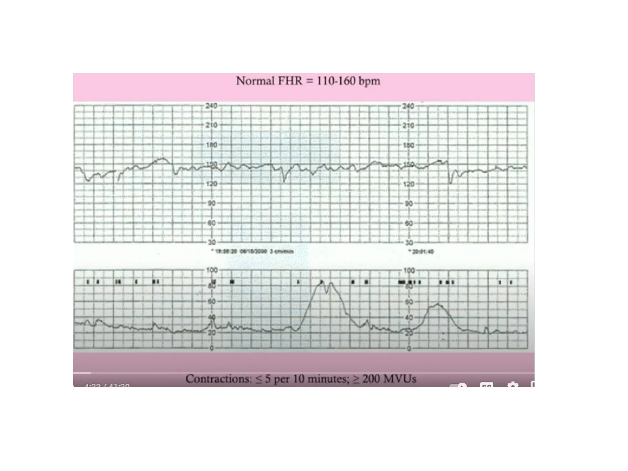 Fetal Monitoring EDITED obe and gyencologyFall24.ppt