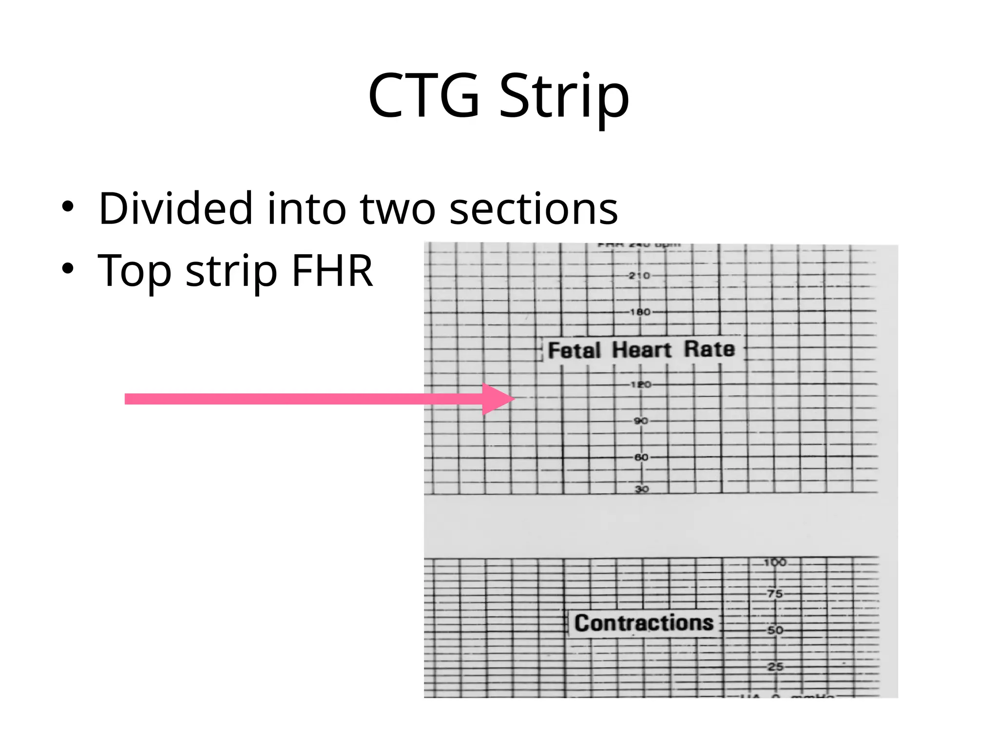 Fetal Monitoring EDITED obe and gyencologyFall24.ppt