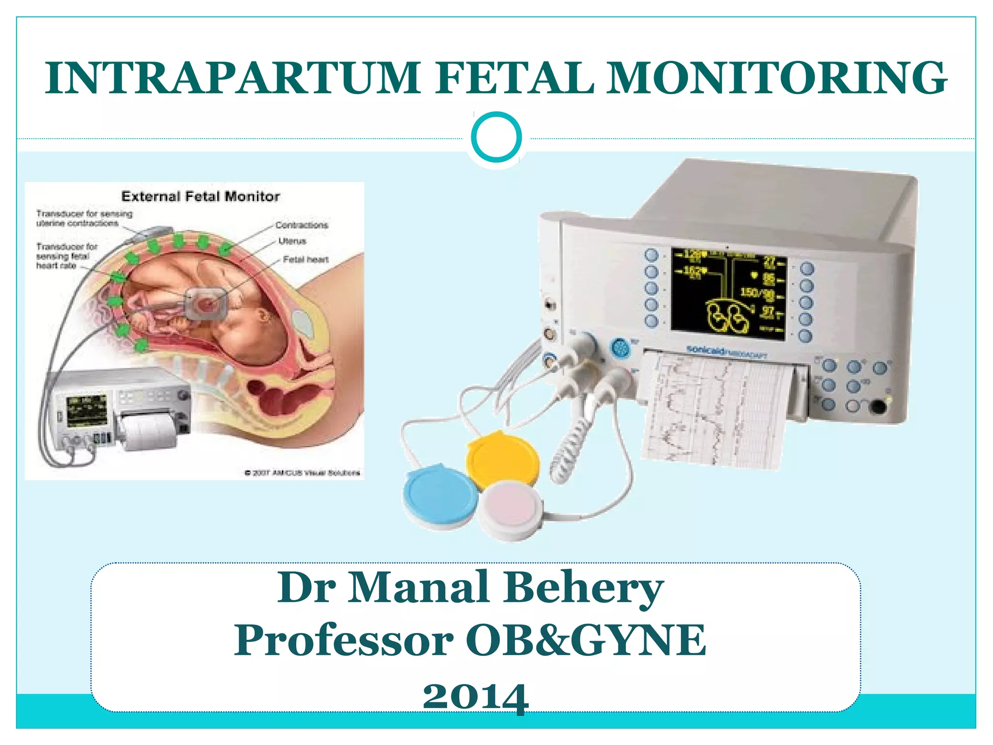 Fetal monitoring for undergraduate | PPT