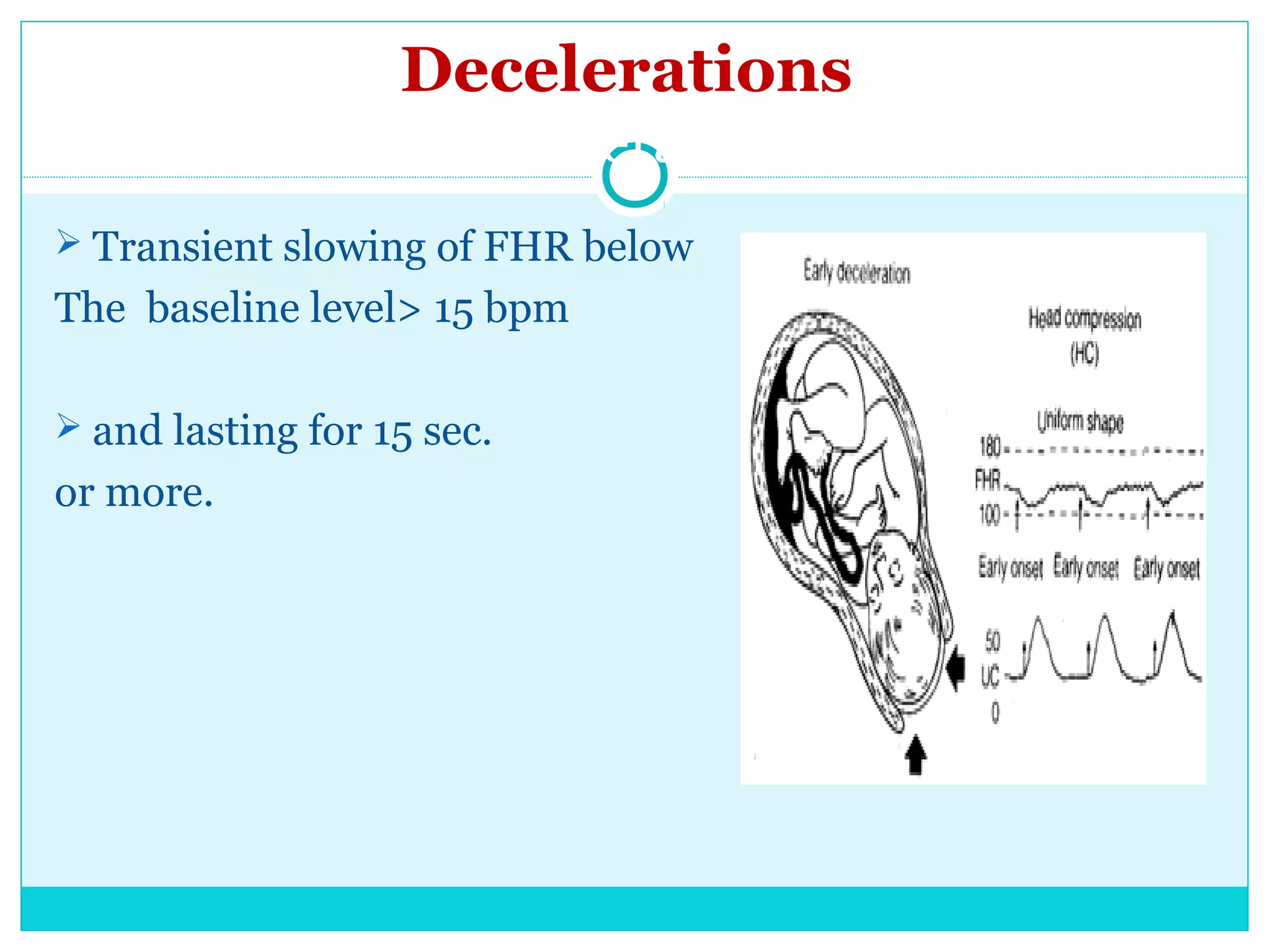 Fetal monitoring for undergraduate | PPT