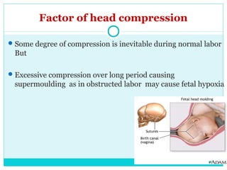 Fetal monitoring for undergraduate | PPT