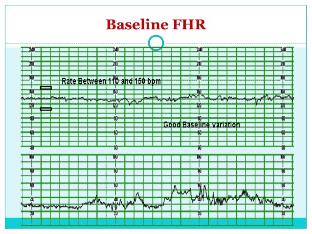 Fetal monitoring for undergraduate